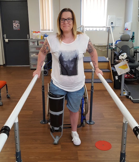 She lost her leg and decided to create a community for disabled people ...